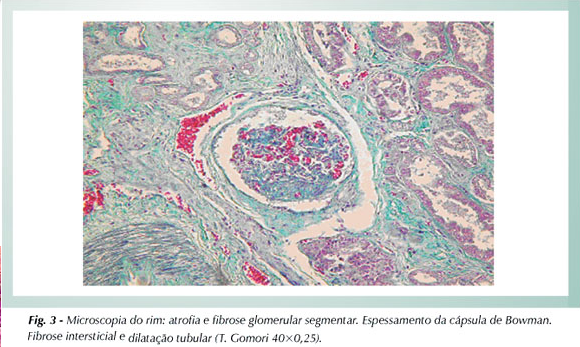 LAICI - Laboratório de Investigação de Câncer e Inflamação ...