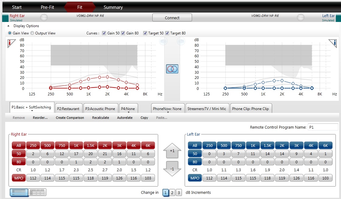 Nick Chitty Hearing Care: Resound Verso Success