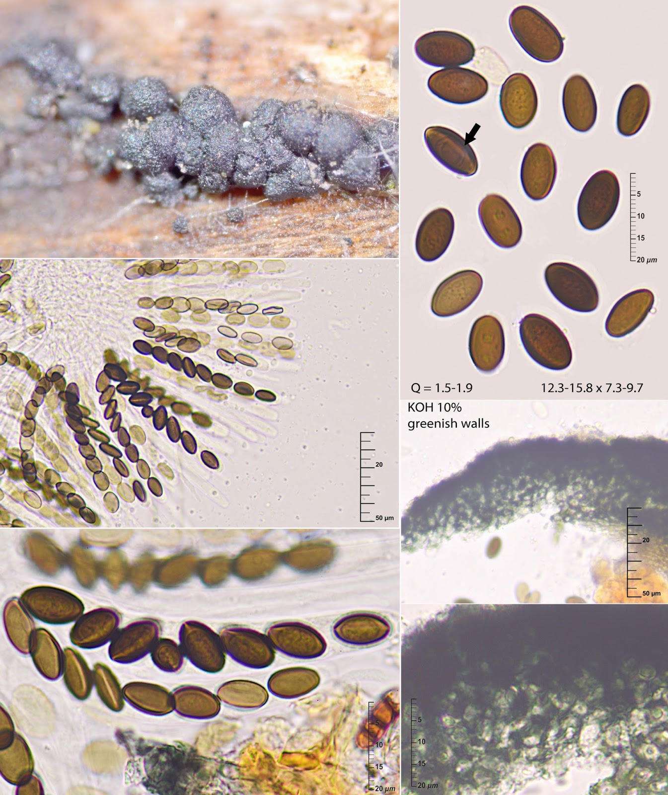 Coniochaeta alkalivirens Checa & G. Moreno • CEMAS esporas oblongas con ...