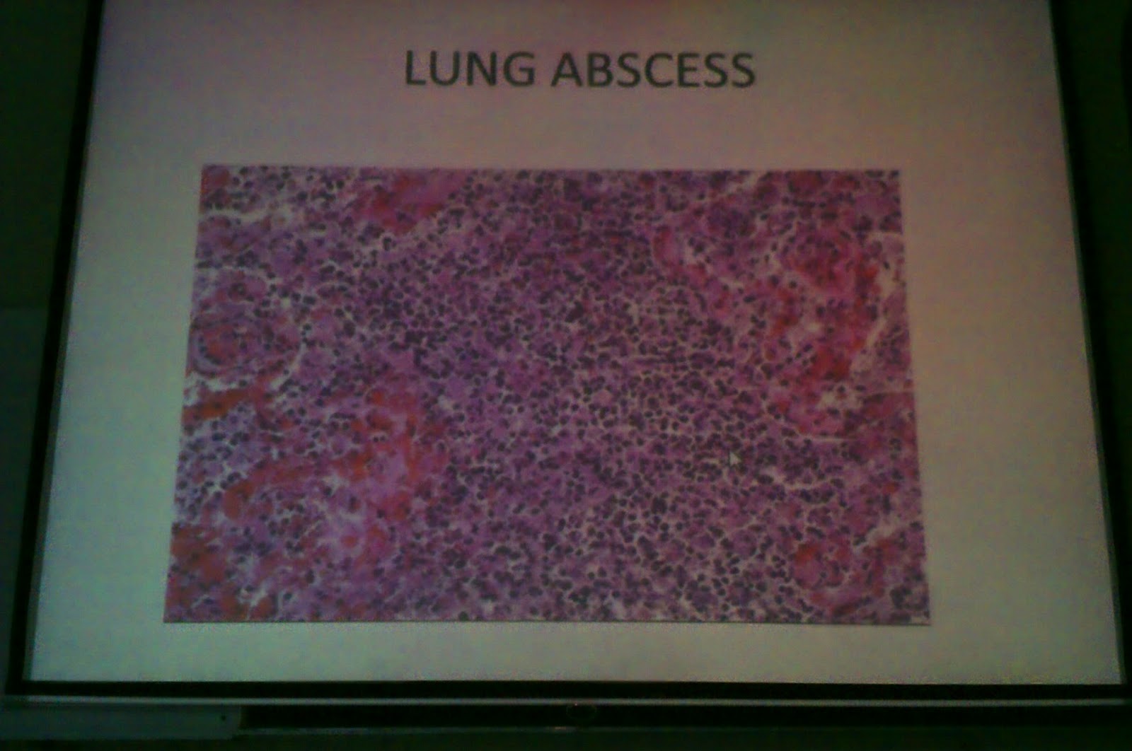 Lecture Slides; Pathology: LUNG