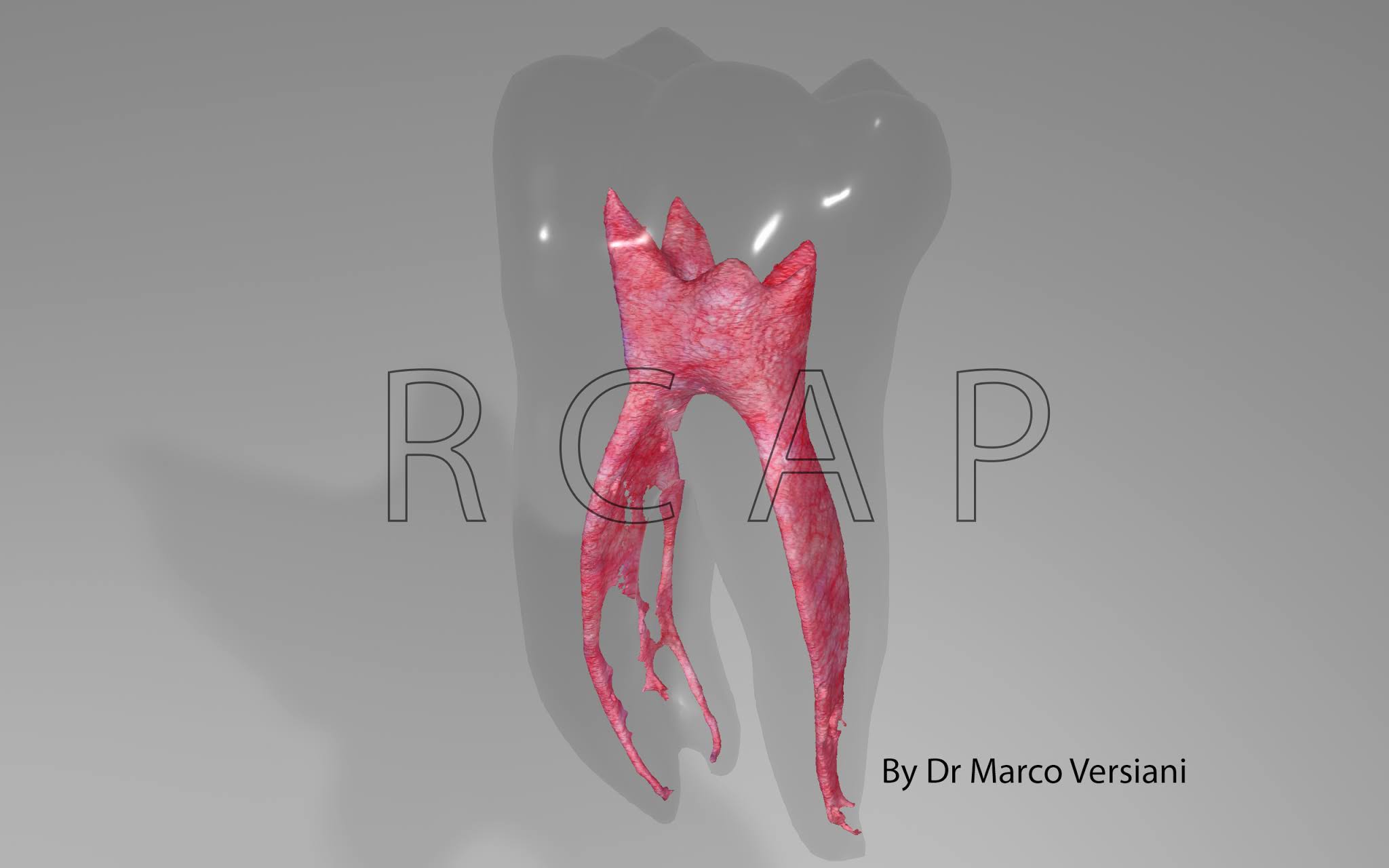 The Root Canal Anatomy Project: Realistic 3D Anatomies