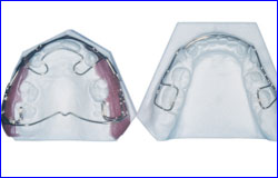 FABRICAR LA APARATOLOGÍA UTILIZANDO DIVERSAS TÉCNICAS Y MATERIALES ...