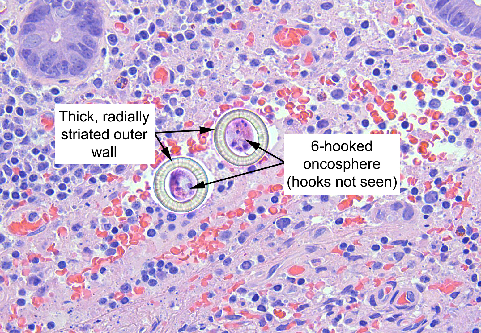 Creepy Dreadful Wonderful Parasites: Answer to Case 608