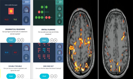 How sleep deprivation affects the brain - Treatment of diseases ...