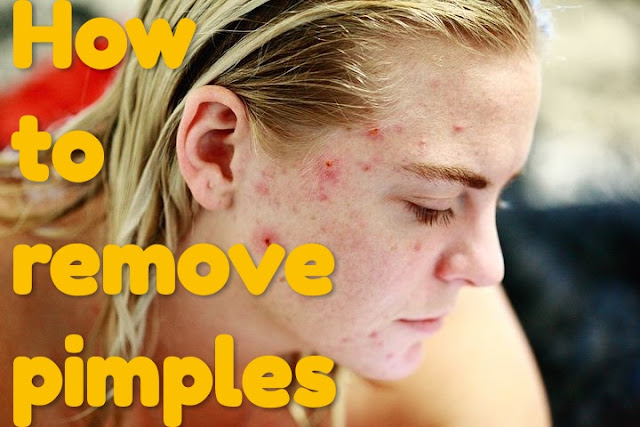 How to Remove Pimples | How to Get Rid of Pimples health tips