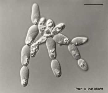 Variety of Life: Microbotryomycetidae