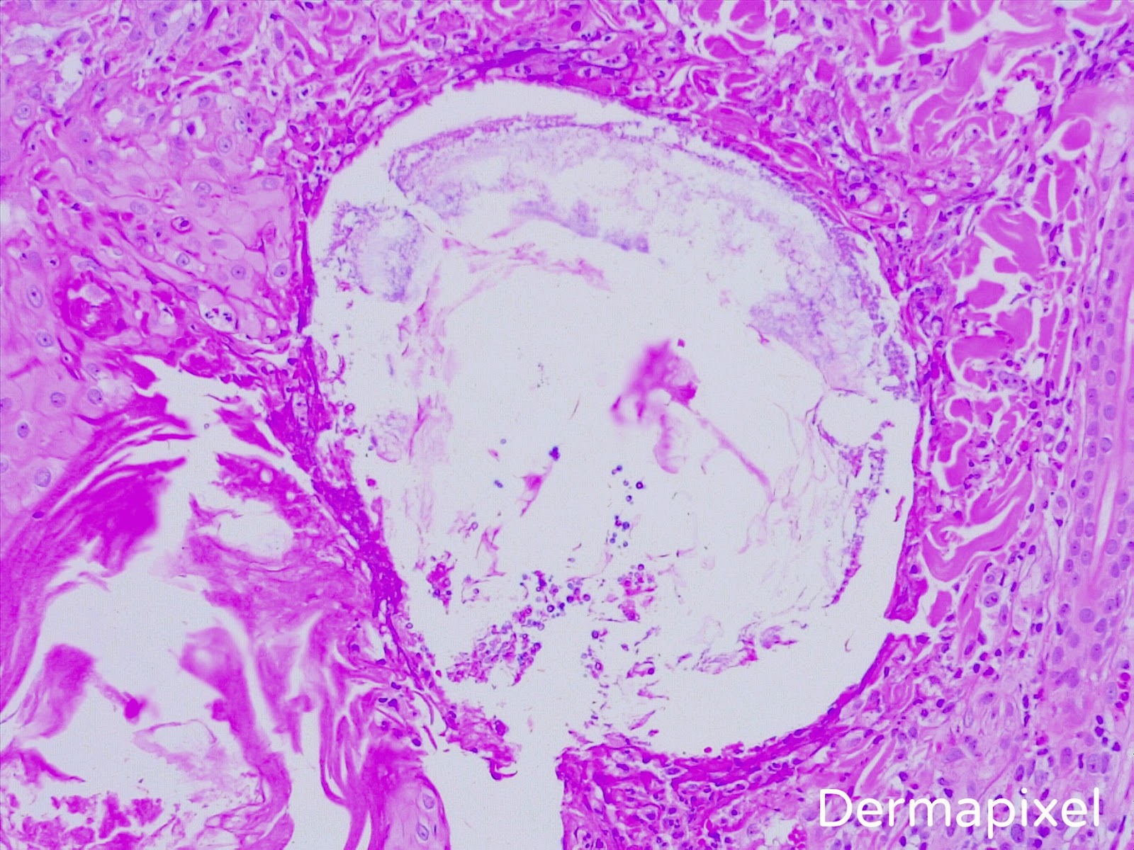 Dermapixel: julio 2017