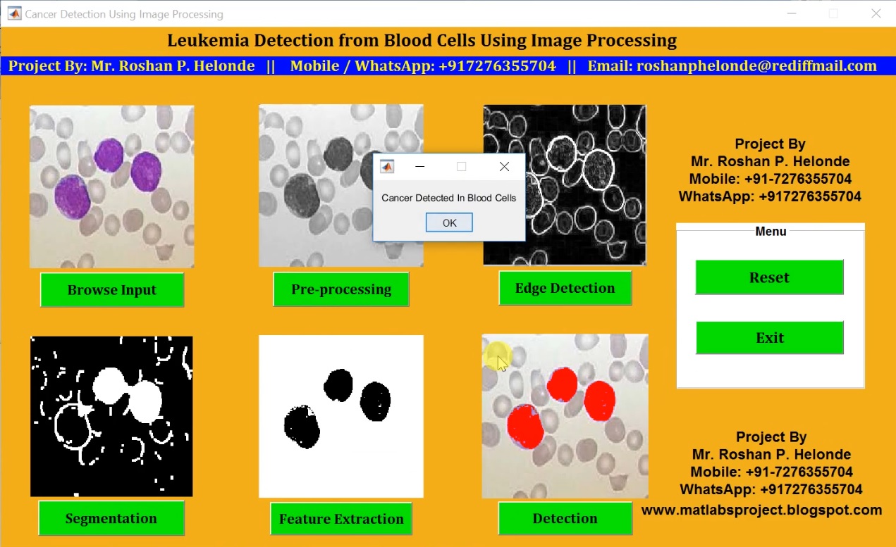 Matlab Code for Blood Cancer Detection using Image Processing ~ Low ...