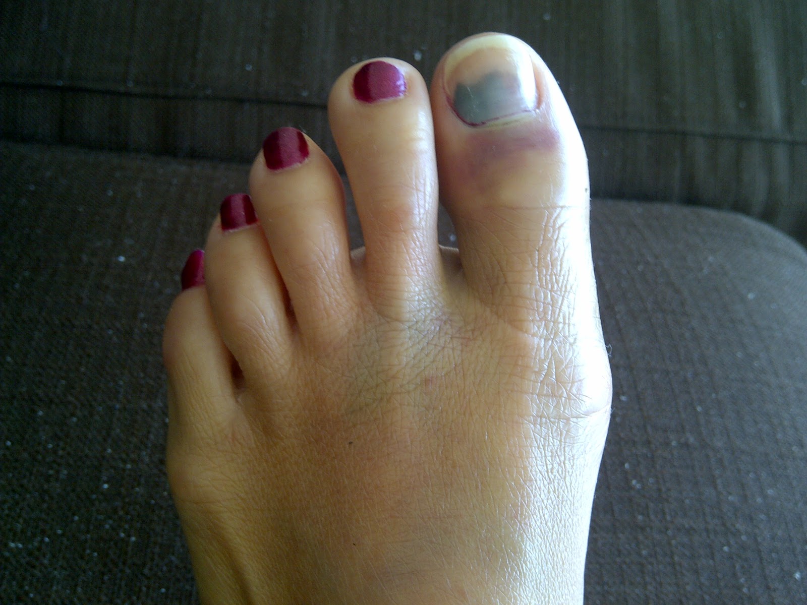 "V in Vondelpark": Toe Story