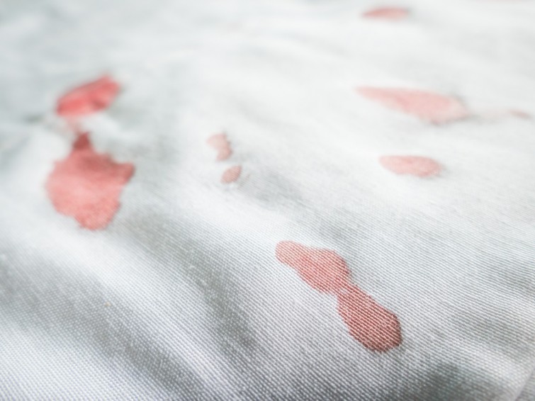 Cosas del día a día: Cómo quitar algunas manchas