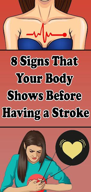 8 Signs That Your Body Shows Before Having A Stroke 8 Signs That Your Body Shows Before Having A Stroke