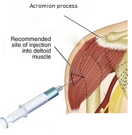 Sites for Intramuscular Injection And Complications
