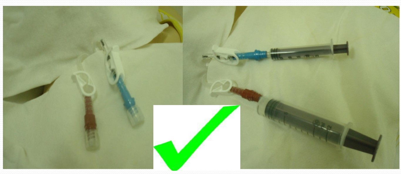 Protocols for Safe and Infection Free Dialysis Unit for Patients