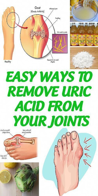 Easy Ways To Remove Uric Acid From Your Joints - wellness magazine