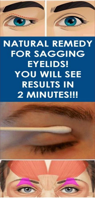 healthy living: Natural Remedy For Sagging Eyelids You Will See Results ...
