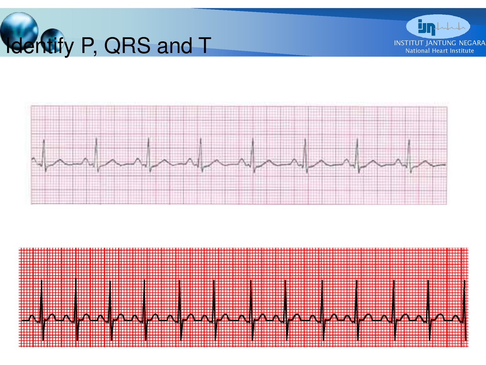 CVT Mohd Farid: Basic ECG Part II-Rate Rhythm Axis