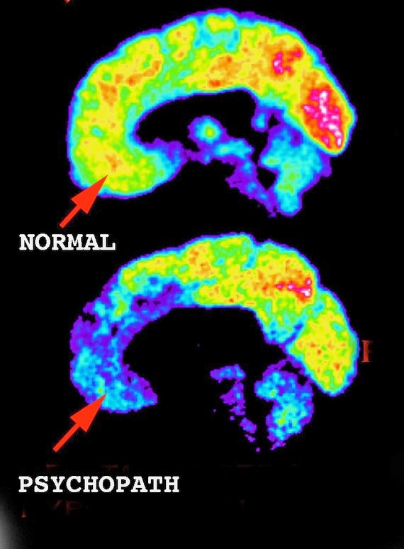 Bob's Blog: Psychopathology, brain development, genetics, and the ...