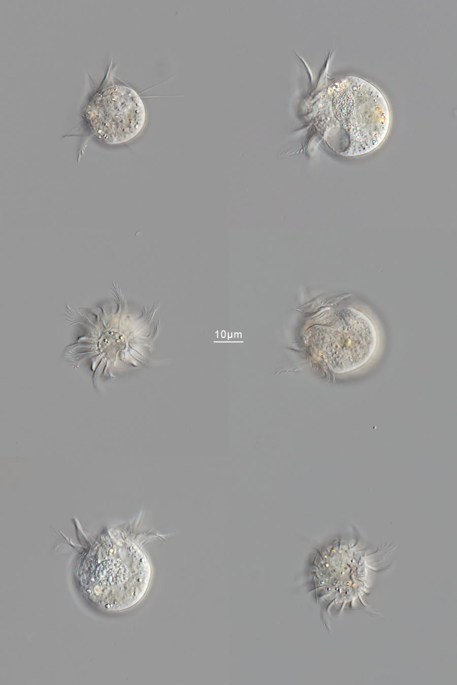 明石・神戸の虫 ときどきプランクトン2: ハルテリア（Halteria sp.）