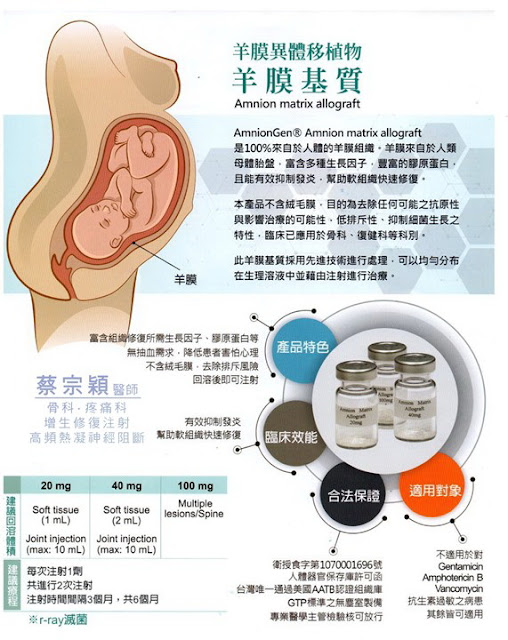 蔡宗穎 醫師 │ 骨科 疼痛 增生注射 脊椎骨盆平衡矯正 脊椎熱凝雷射 : 羊膜異體移植物 AMNIOGEN® 介紹 & 開箱使用分享