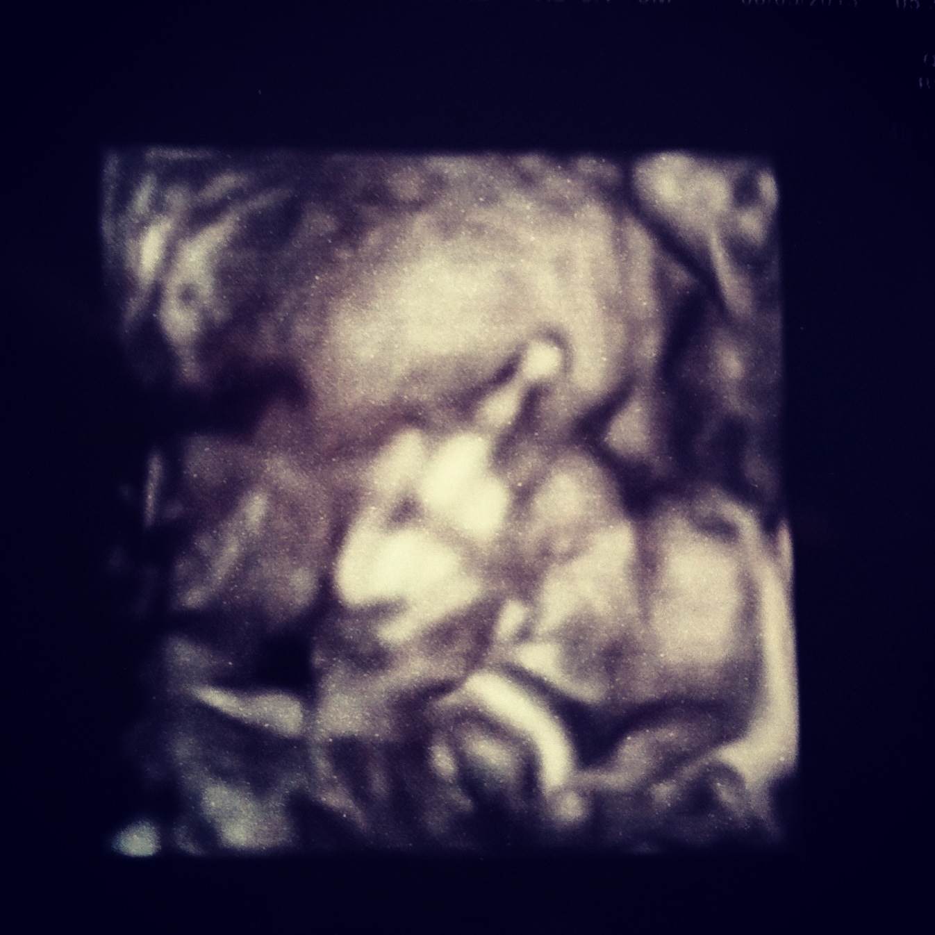 Boogie on Baby Fournie: Dear Baby (27 weeks, 6 days)