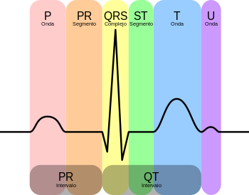 Curso de Lectura Electrocardiografica Veloz: Bloqueos