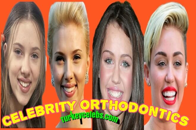 Celebrity orthodontics the best celeb tooth transformations ever.