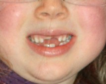 Gappy teeth - Mum of Three World