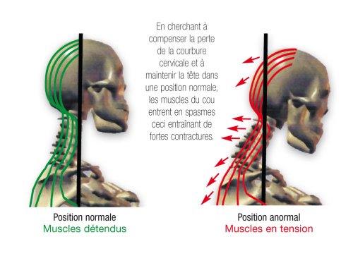 Blog 75: Infos santé : Sport et Santé-Douleurs cervicales et auto ...