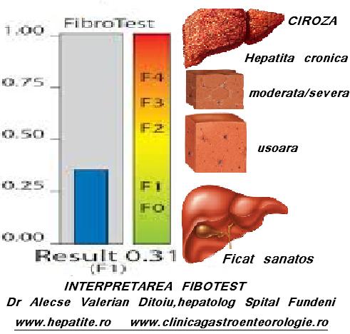 Clinica gastroenterologie Bucuresti: Cum se vede daca ai fibroza hepatica