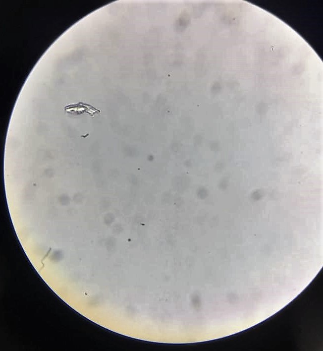 Jurnal Praktikum Mikrobiologi: PENGAMATAN MIKROSKOPIS KHAMIR, KAPANG ...