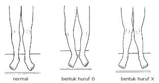 Tasangkuik Channel: Tips dan Trik Tes Kesehatan 1 Polisi