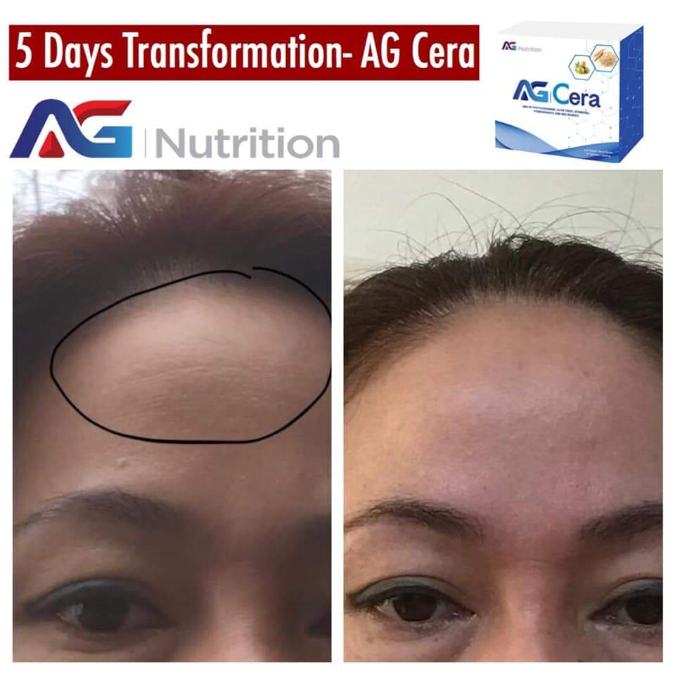 AG CERA | SUPLEMEN ANTI OKSIDAN TERBAIK DI DUNIA | KEMBALI SIHAT DAN ...