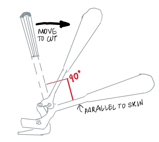 Medicowesome: Plaster Removal