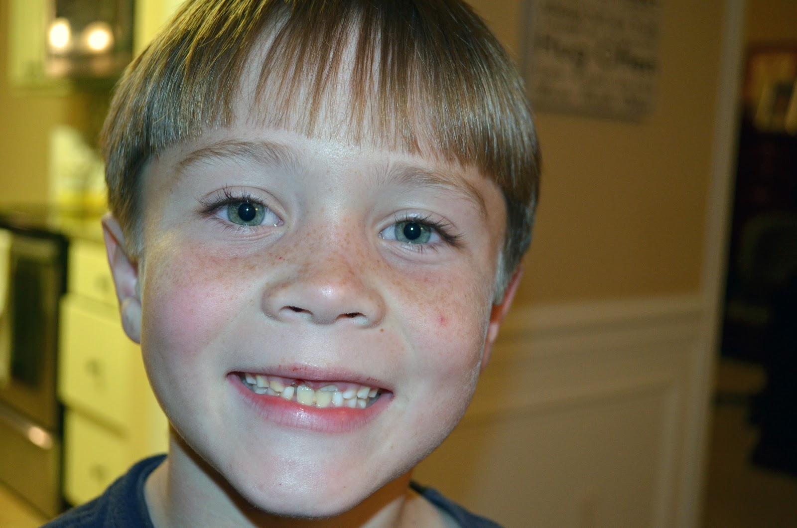 Living With Boys: All I Want for Christmas is My Two Front Teeth