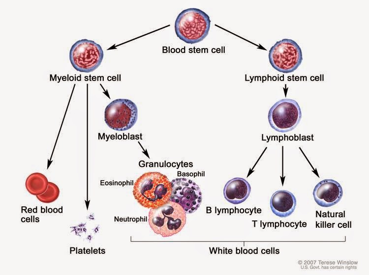 Acute Lymphoblastic Leukemia (ALL): Pathophysiology