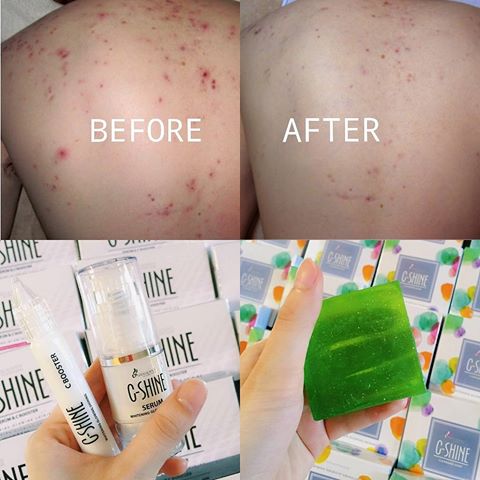 C-SHINE SERUM & C BOOSTER MURAH | Harga Murah Original cikza beauty shop