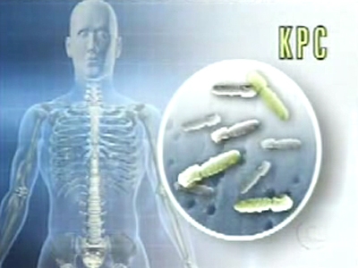 Jb Conhecimentos: O que é a bactéria KPC?