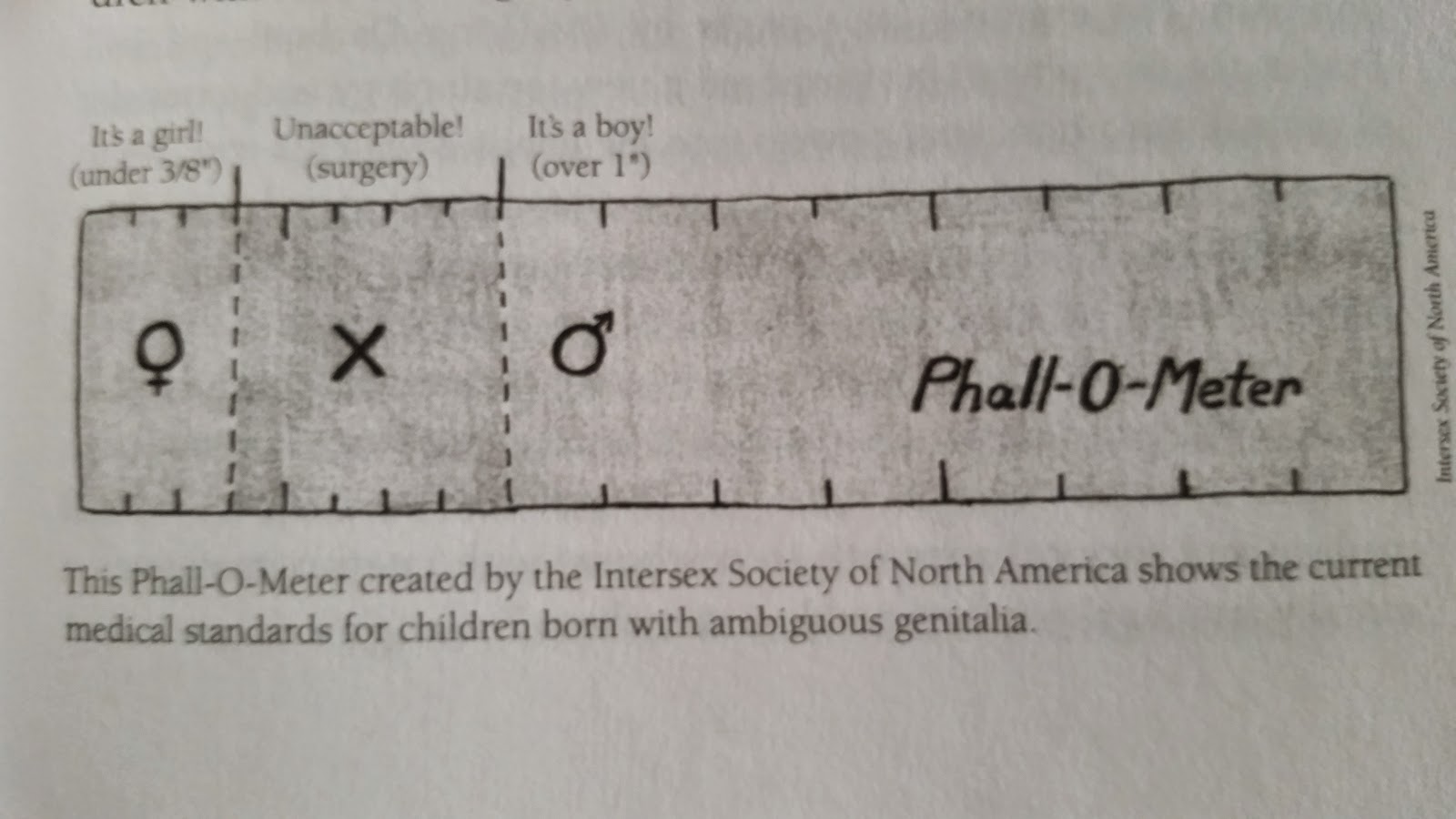 My CAIS: Complete Androgen Insensitivity Syndrome