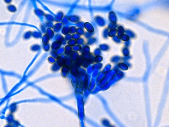 Fun With Microbiology (What's Buggin' You?): Scopulariopsis brumptii