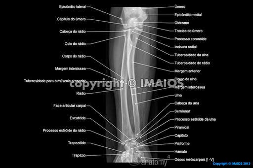 Radiologia : Radio e Ulna