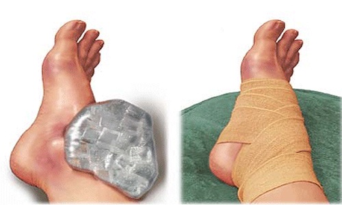 Primeros Auxilios Básicos en el lugar de Trabajo: Contusiones