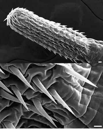 Parasite of the Day: Acanthocephalus rhinensis