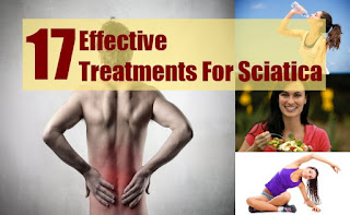 Sciatica treatments: What Is Sciatica?