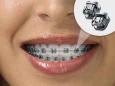 ♥ [♀] Crystal. The Life [♂] ♥: The first step to do before you put on ...