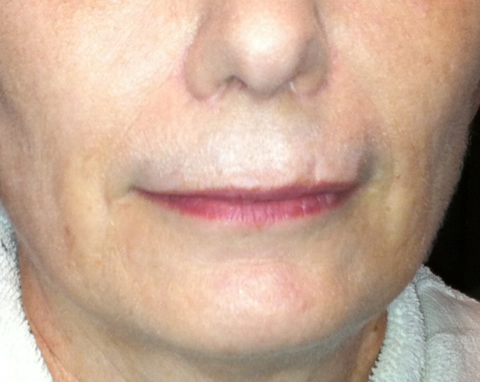 Steel Magnolias Salon Blog: No Lips? No Problem!