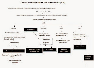 Pathway Rematoid Heart Disease (RHD) - Pathway Patofisiologi