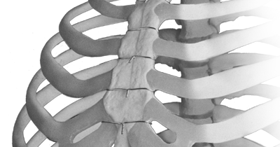 OpenHeartWarrior: Sternal Wires and Listening