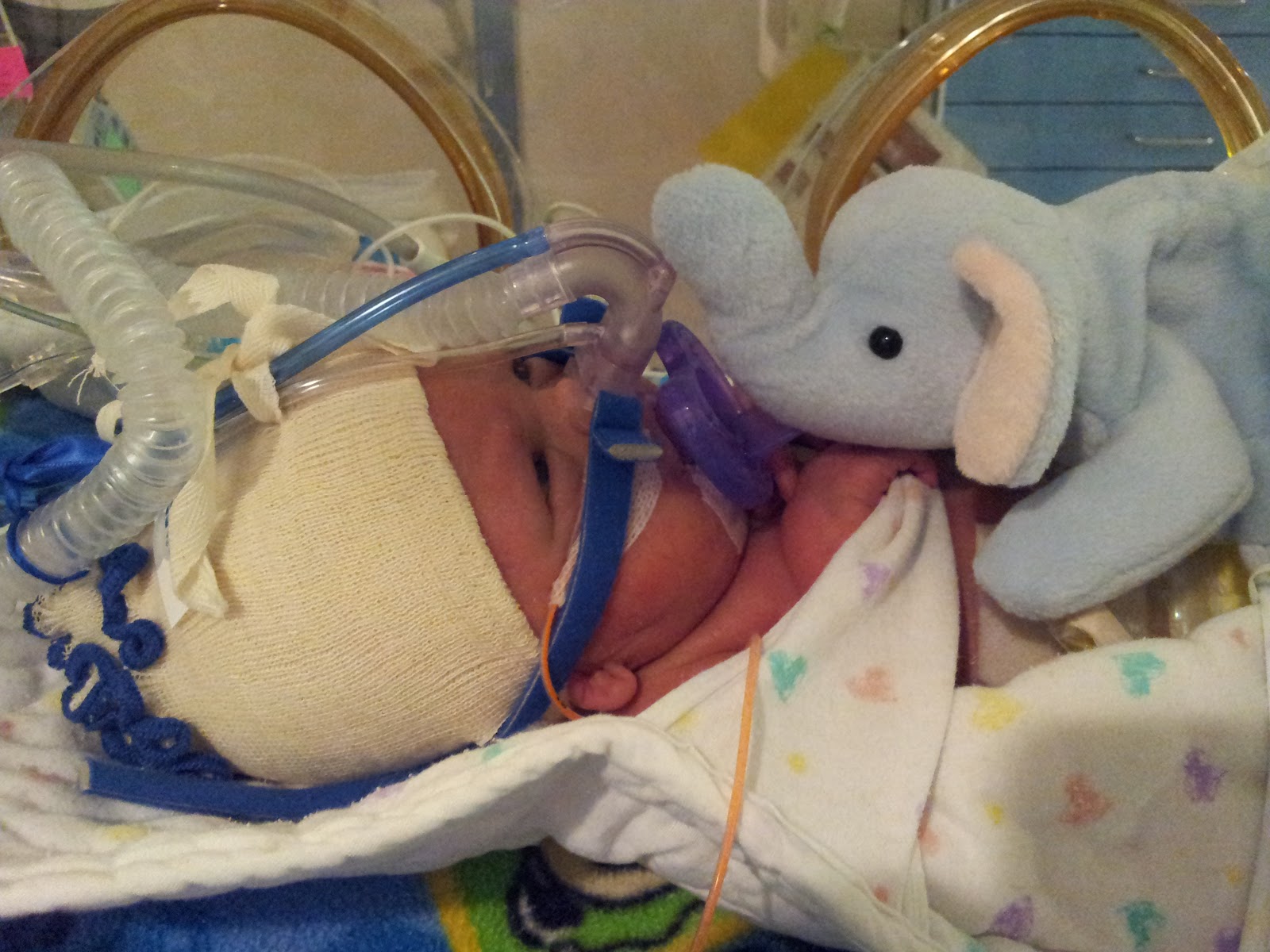 A Three E Circus: Baby Eagan - NICU Day 96 - Self Extubation