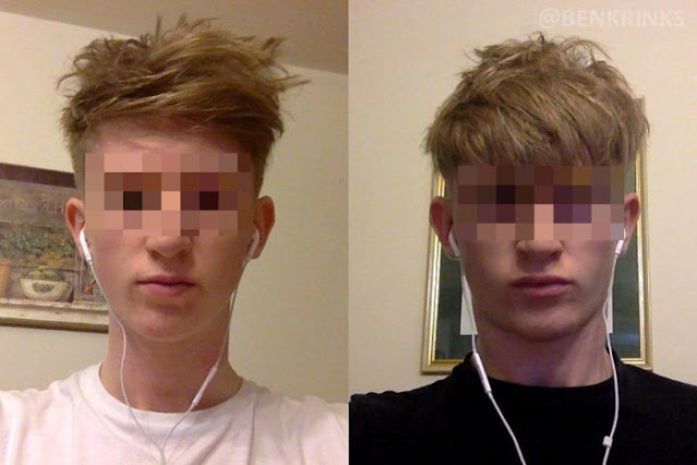 Những điều bạn cần biết về mewing ~ The beausty