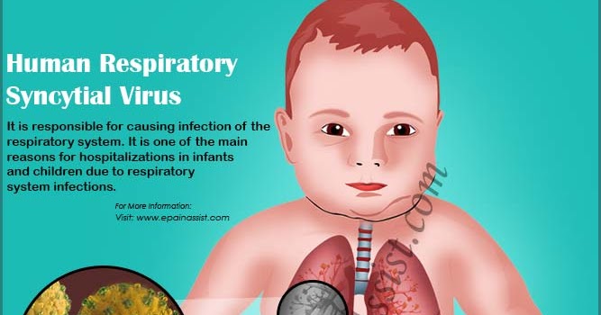 Respiratory syncytial virus